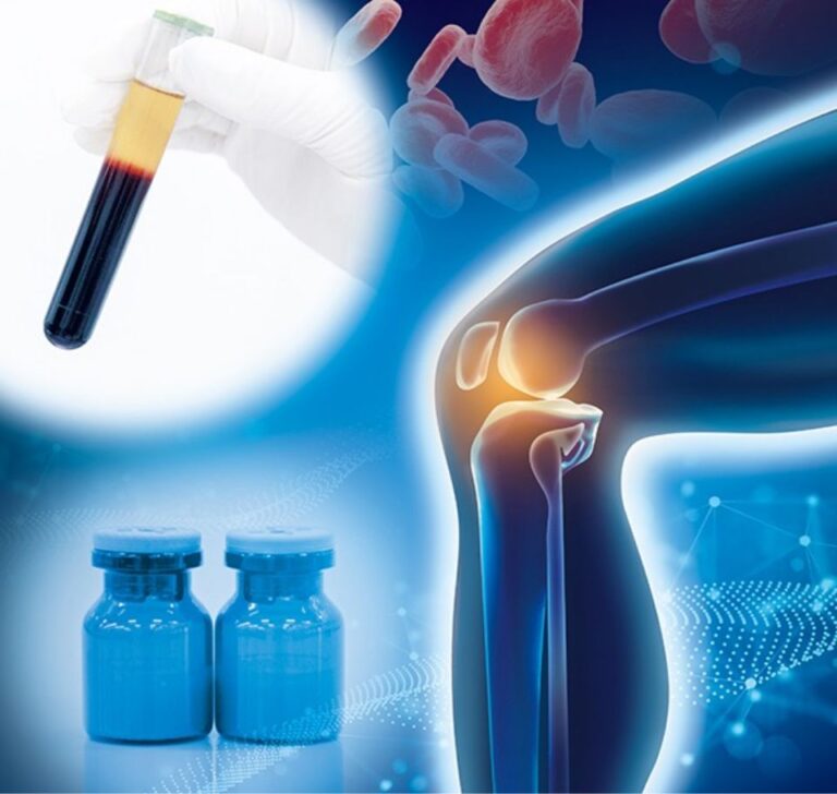 切らない膝の再生医療PRP-FD｜【小林病院】千葉県館山市